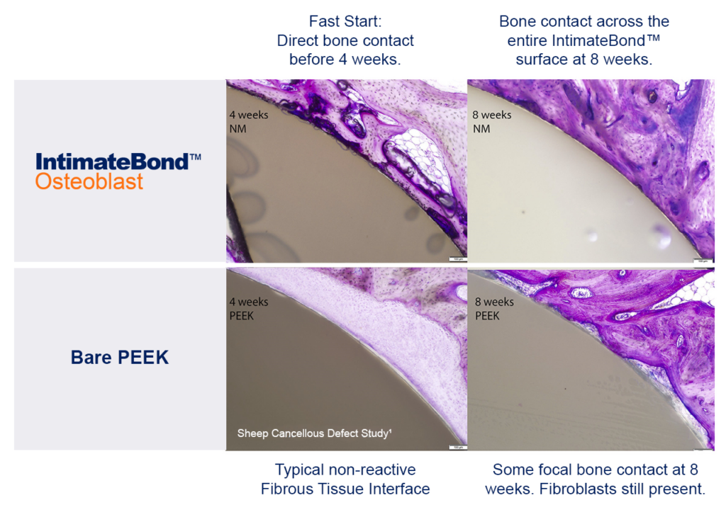 Intimate Bond - Implant Surfaces