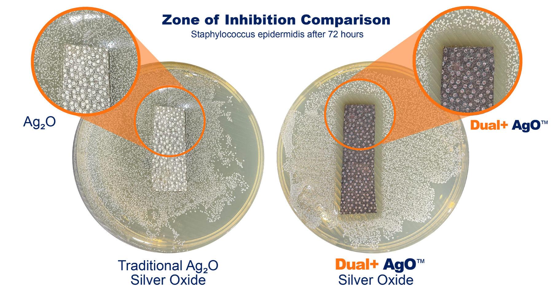 Dual+ AgO - Implant Surfaces